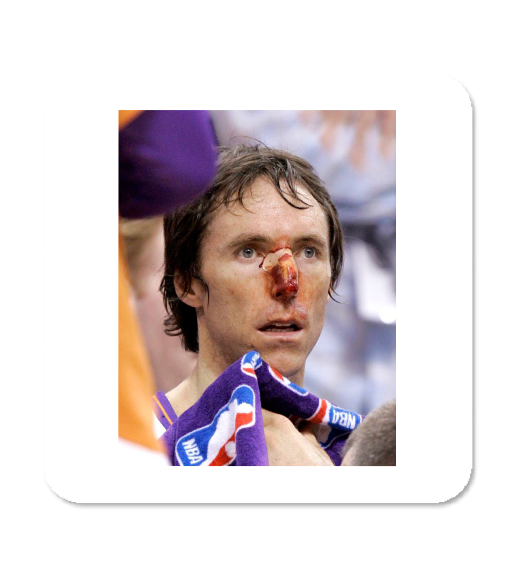 Steve Nash Nose